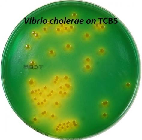 Thiosulphate Citrate Bile Salts Sucrose Agar ( TCBS agar) | Medical Laboratories