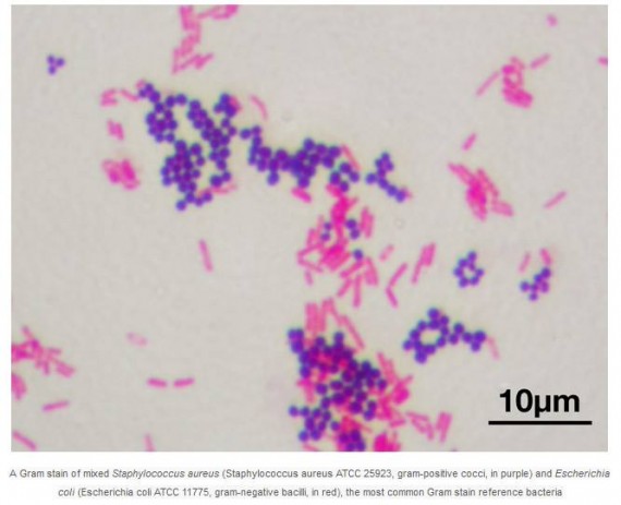 Gram staining | Medical Laboratories