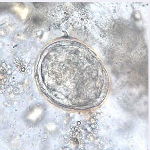 Schistosoma Japonicum