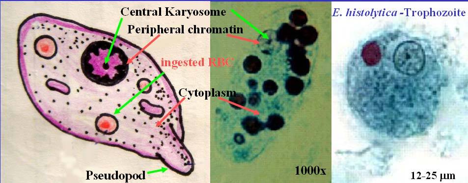 Entamoeba histolytica trophozoite | Medical Laboratories