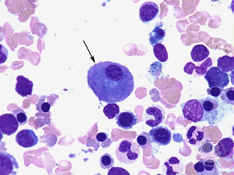 Flame Cell | Medical Laboratories
